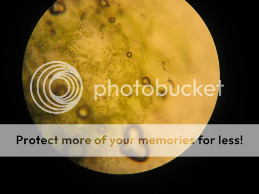 Some micro photos : Photos of Venus Fly Traps